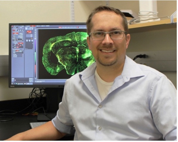 Stroke-IMPaCT | In Profile: Kristian Doyle